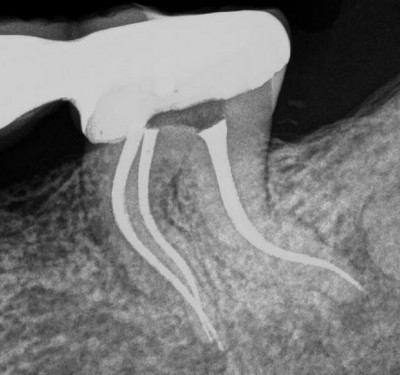 The Running Man - Reno Endodontics